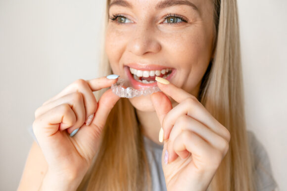 Transforming Your Smile and Oral Health with Invisalign at Celebrity ...